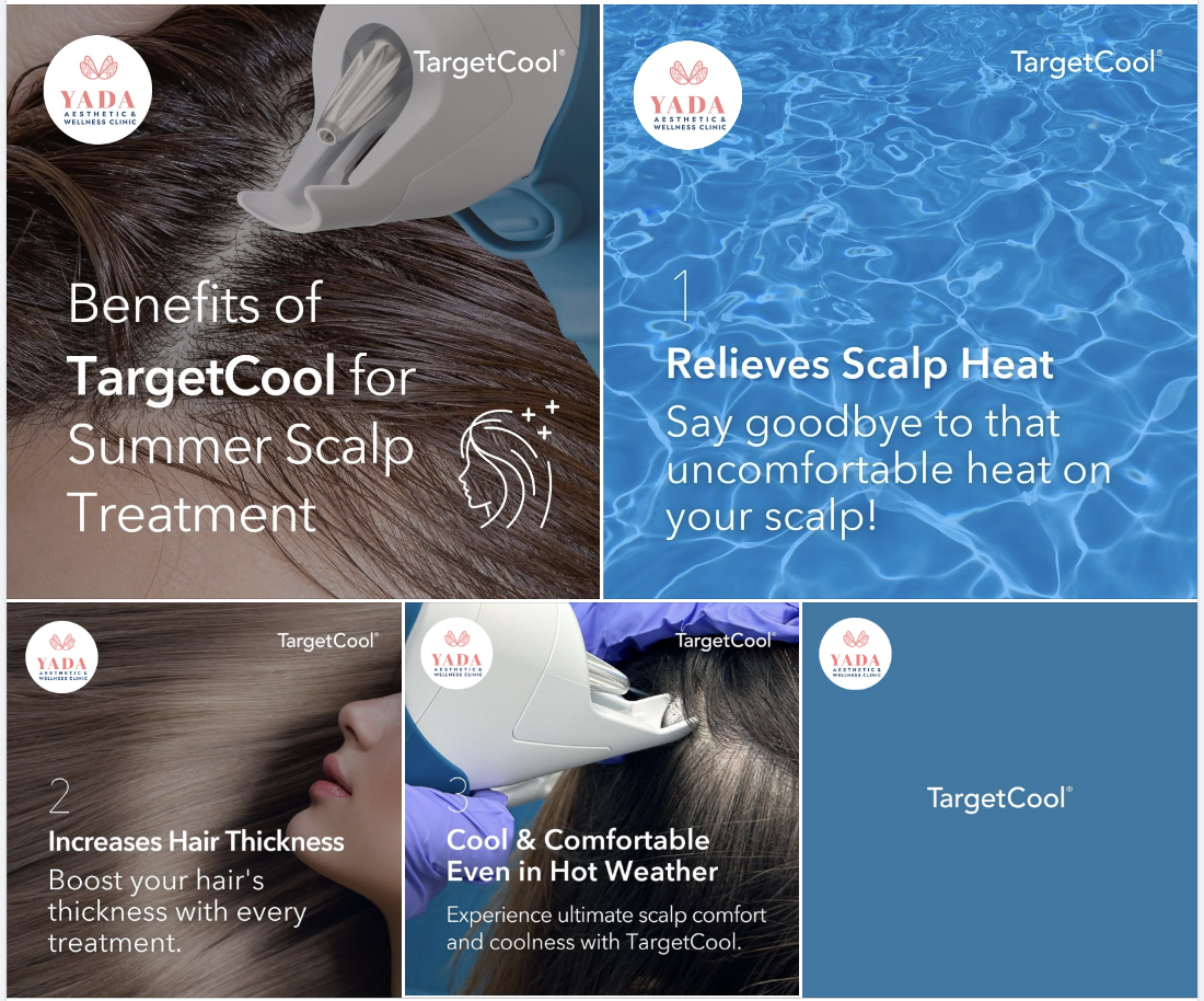 TargetCool for hair and scalp บำรุง ดูแล ผม หนังศรีษะ Yada Clinic ...